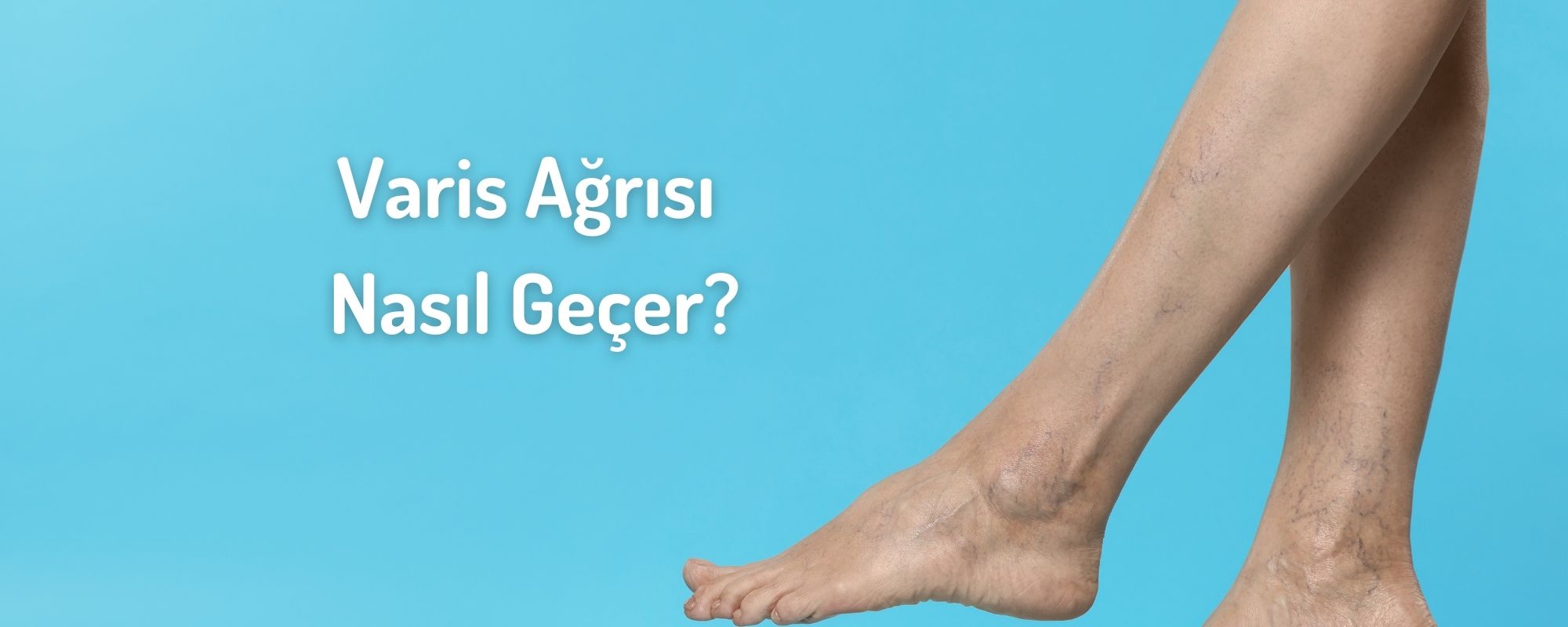 Varis Hastalığı İle İlgili Merak Edilenler.